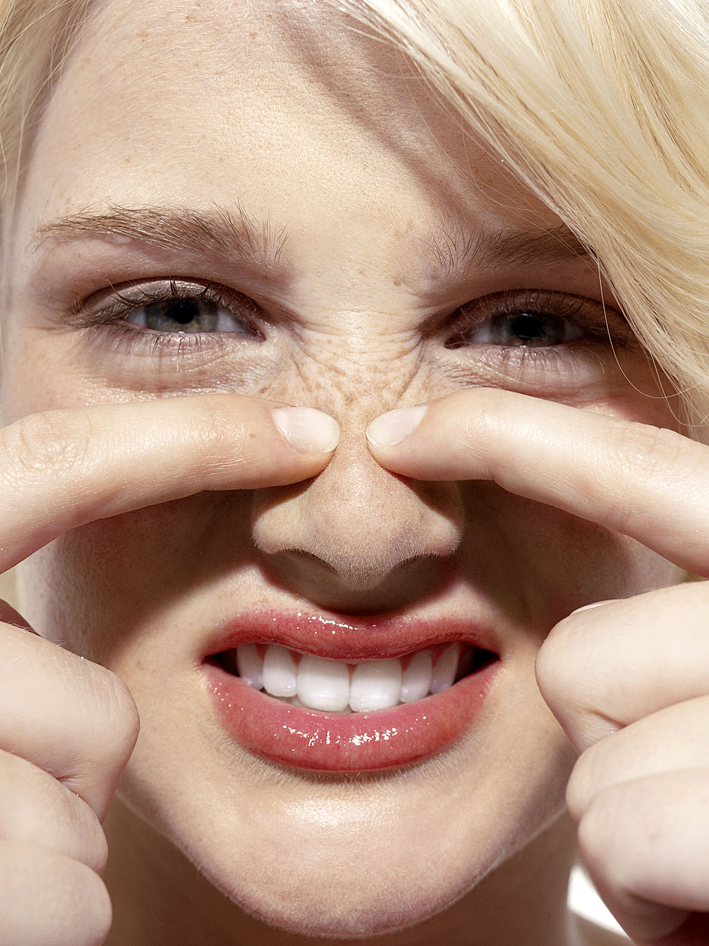 Pimples On The Nose Causes And Treatments SmuGG BuGG Pimples On The Nose Causes And Treatments SmuGG BuGG